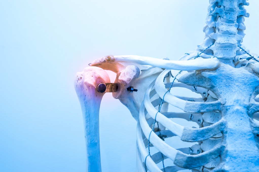 Northgate Shoulder Pain & Conditions Treatment - OPAOrtho